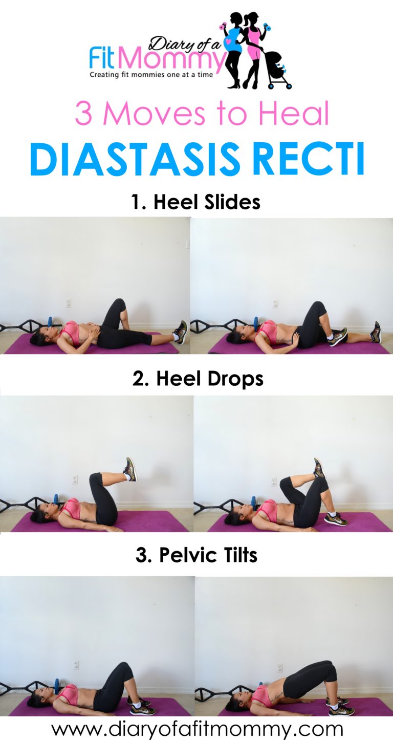 The Complete Guide to Getting Rid of Diastasis Recti - Diary of a Fit Mommy