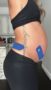 Kinesio Taping For Pregnancy Pain & Aches + 7 Taping Techniques That WORK! - Diary of a Fit Mommy